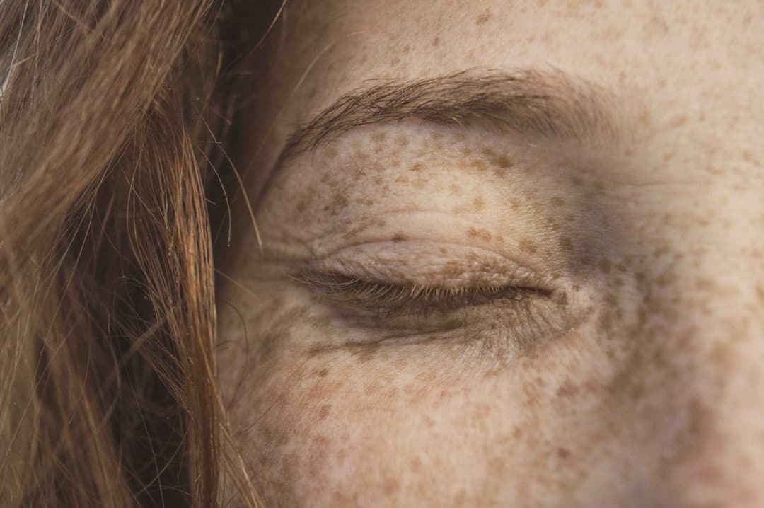 DermScreen | Digital Dermatology Solutions
